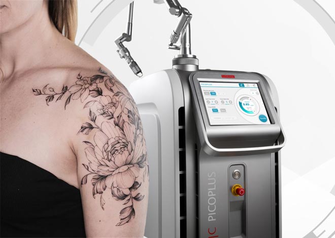 Tattooentfernung - tattoofrei-dresden.de